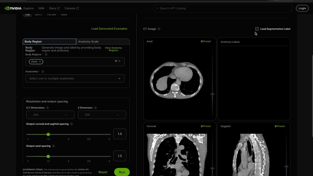 Next Gen Medical Imaging with AI | Pure Storage