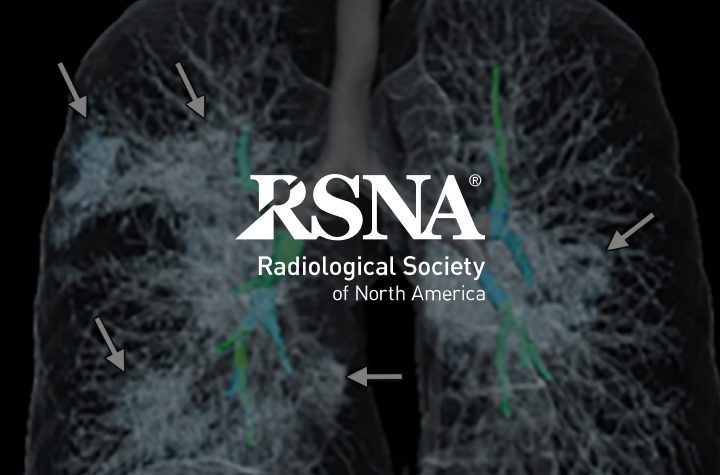RSNA Accelerates Access to Research and Education for Members | Pure ...